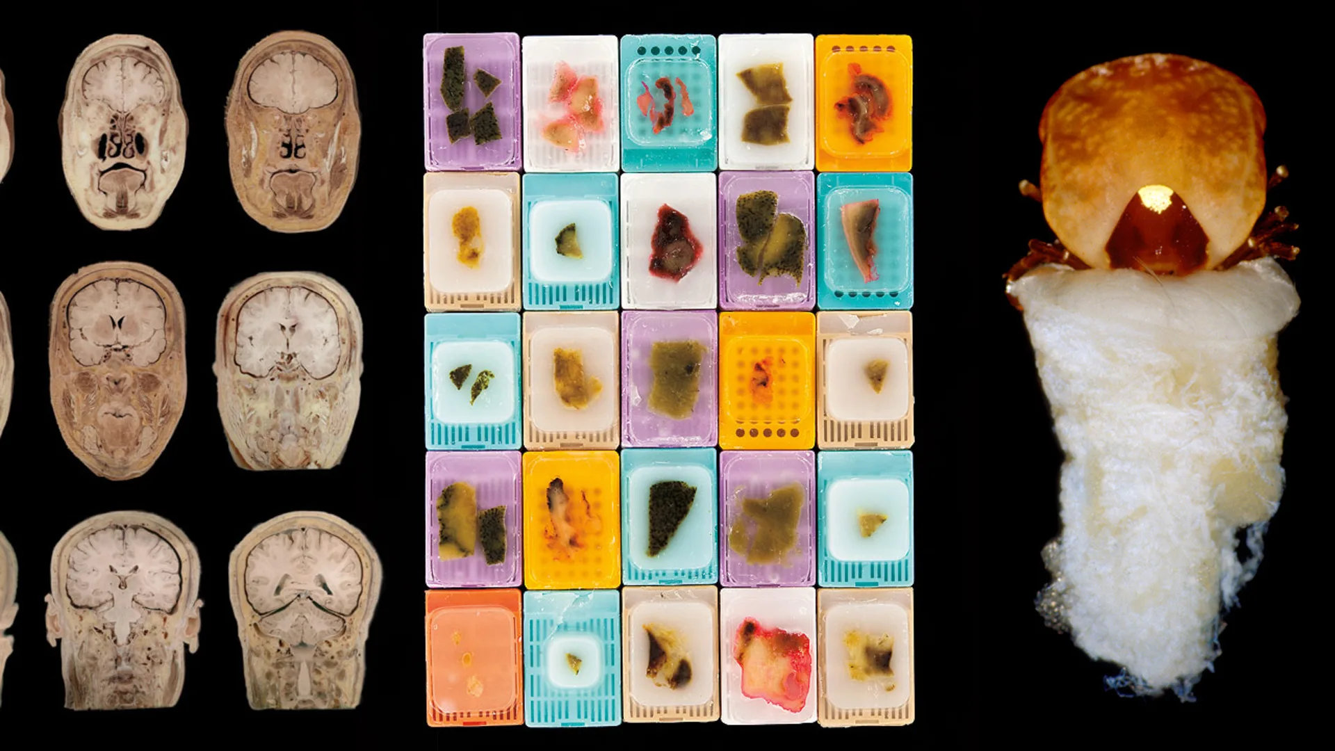 Photos Showcase The Hidden Beauty Of Dread Diseases - Fast Company