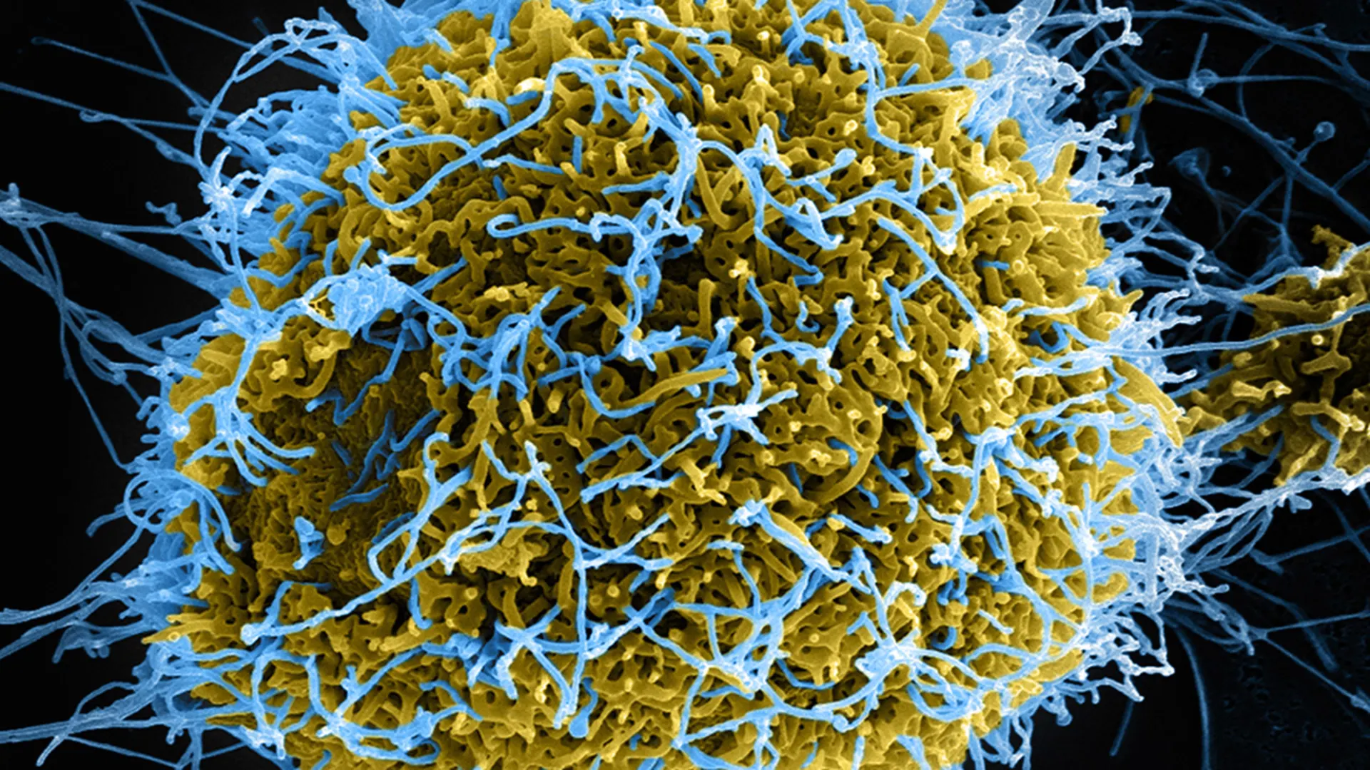 IBM Announces Magic Bullet To Zap All Kinds of Killer Viruses - Fast ...