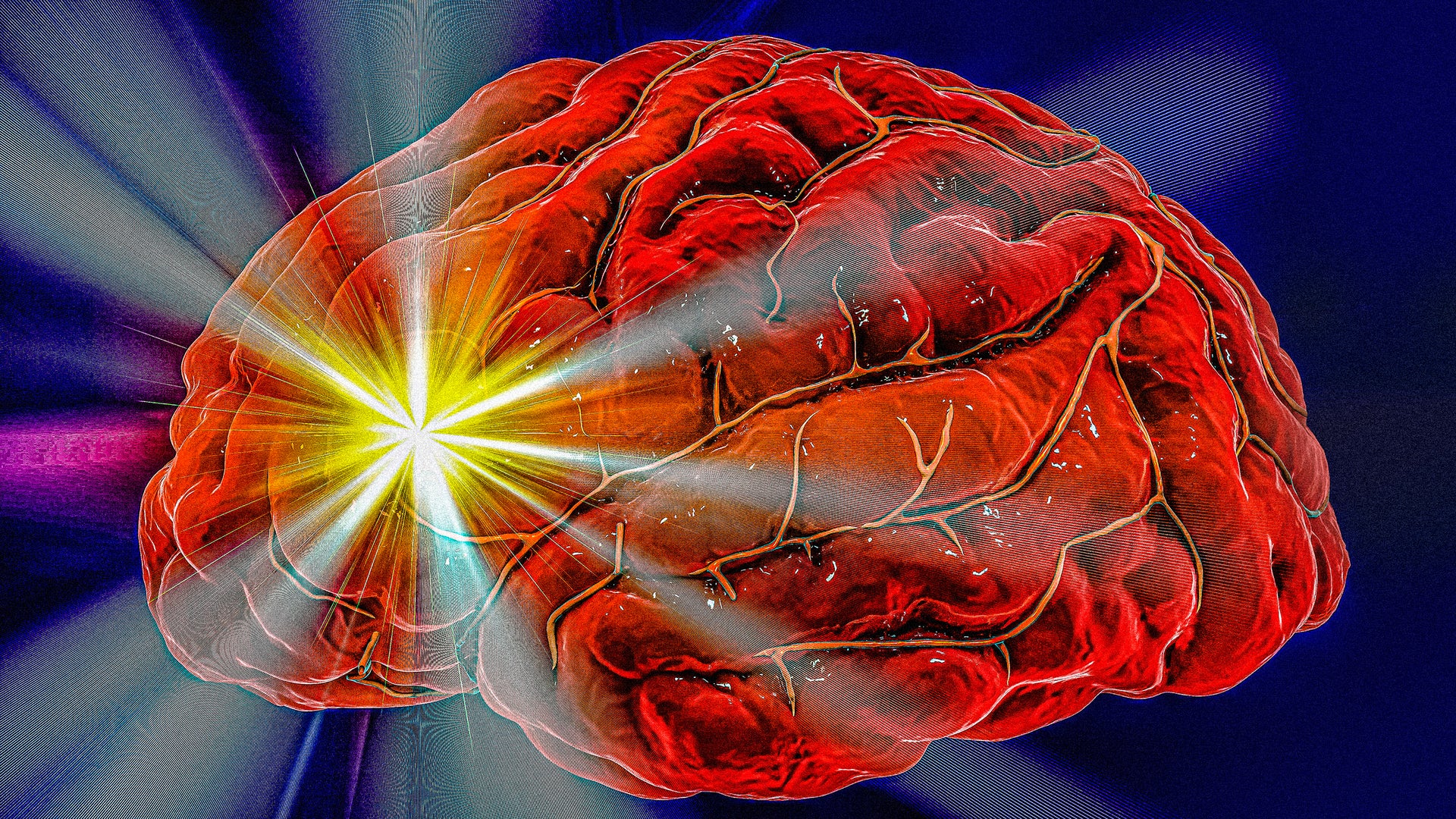 This smartphone app detects if users are having a stroke - Fast Company