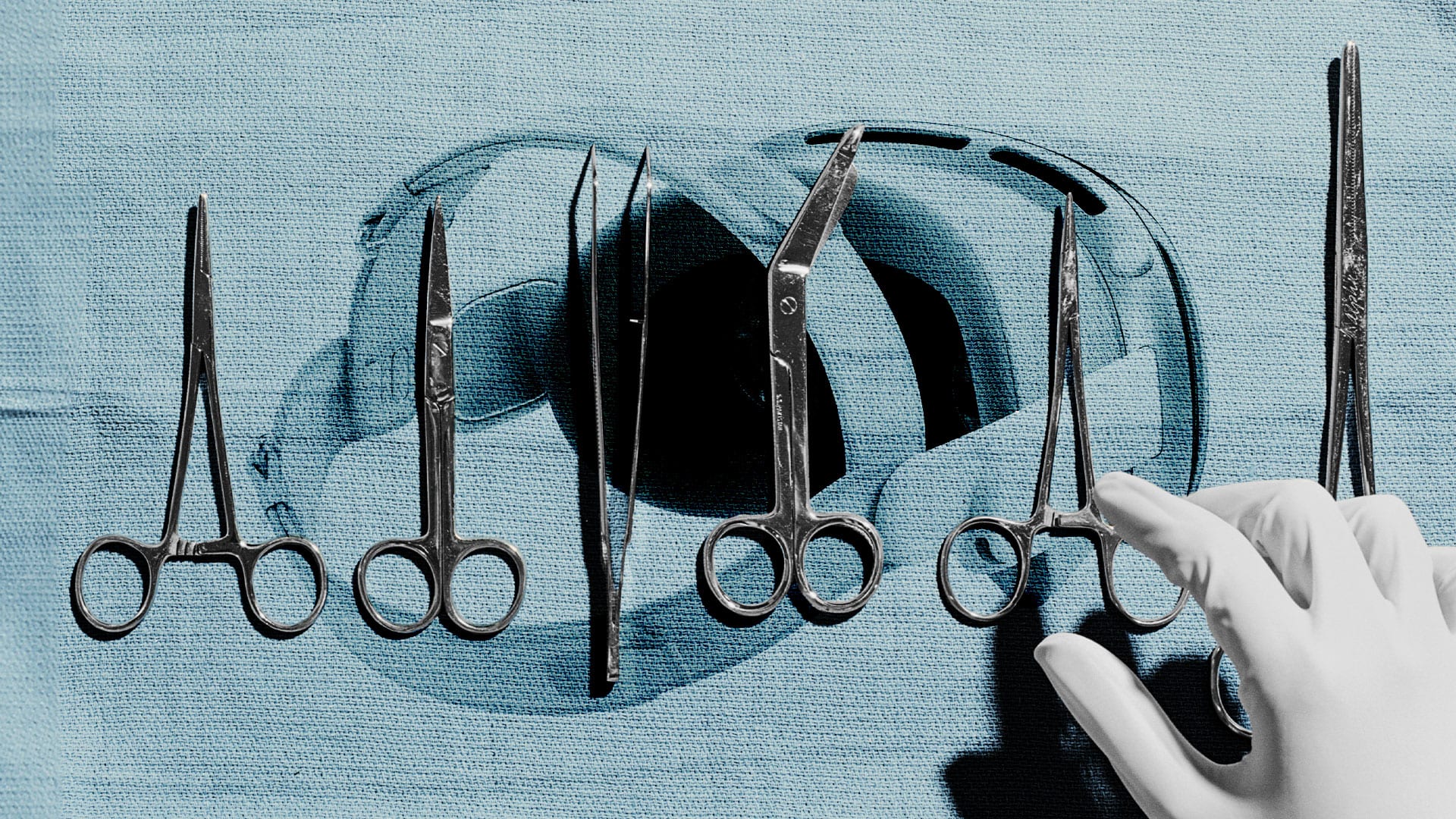 Surgeons are using Apple Vision Pro in operation: What could go wrong?