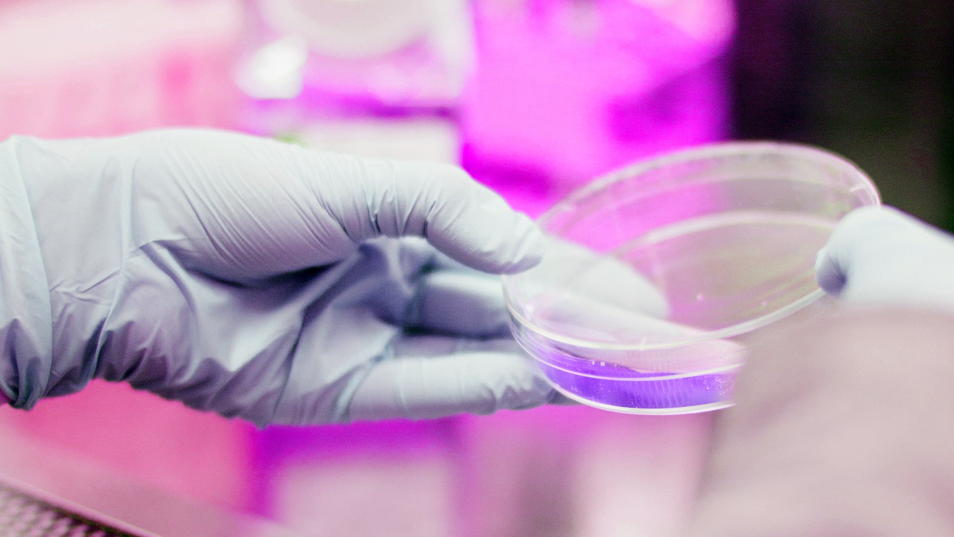 American scientists just made their first attempt to edit a gene in a ...