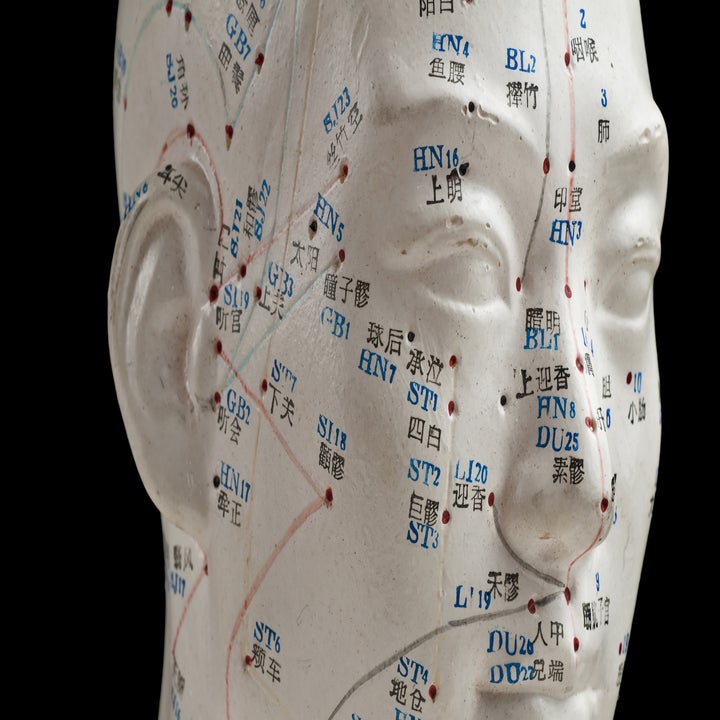 A New High-Tech Upgrade To Acupuncture Lets You See It's Working In ...