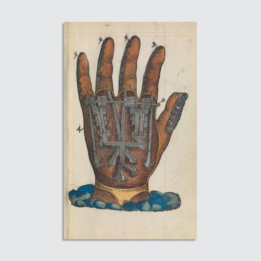 Amputations and iron hands: How modern surgery came about - Fast Company