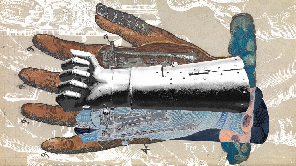 Amputations and iron hands: How modern surgery came about - Fast Company