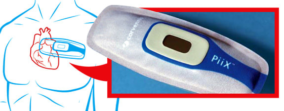 Corventis's PiiX Monitor Promises to Predict Heart Failure - Fast Company