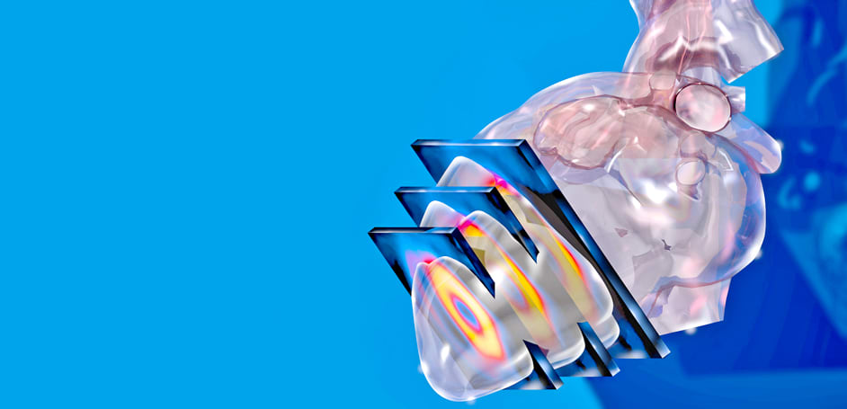 Rhythmia Medical Maps A Better 3-D Picture Of A Beating Heart-From The ...