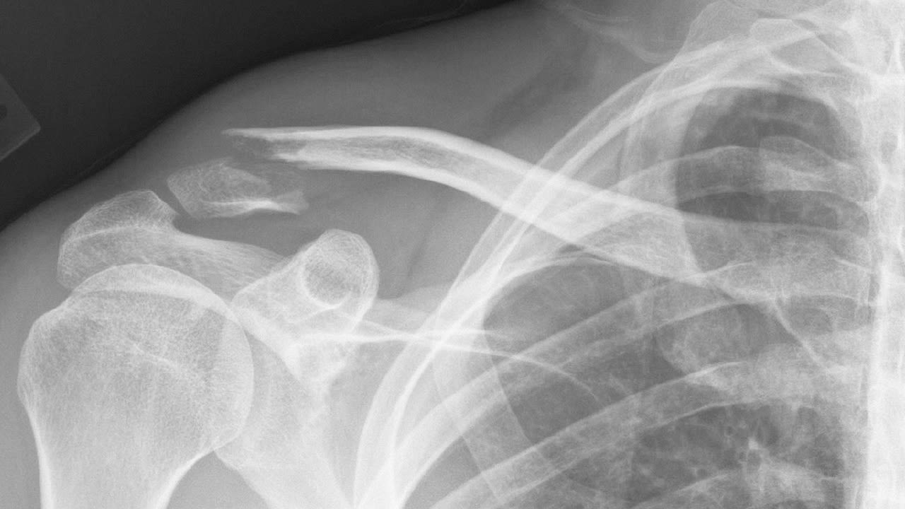 How 3-D-Printing Bones Is Just The Start Of Repairing Your Own Body ...