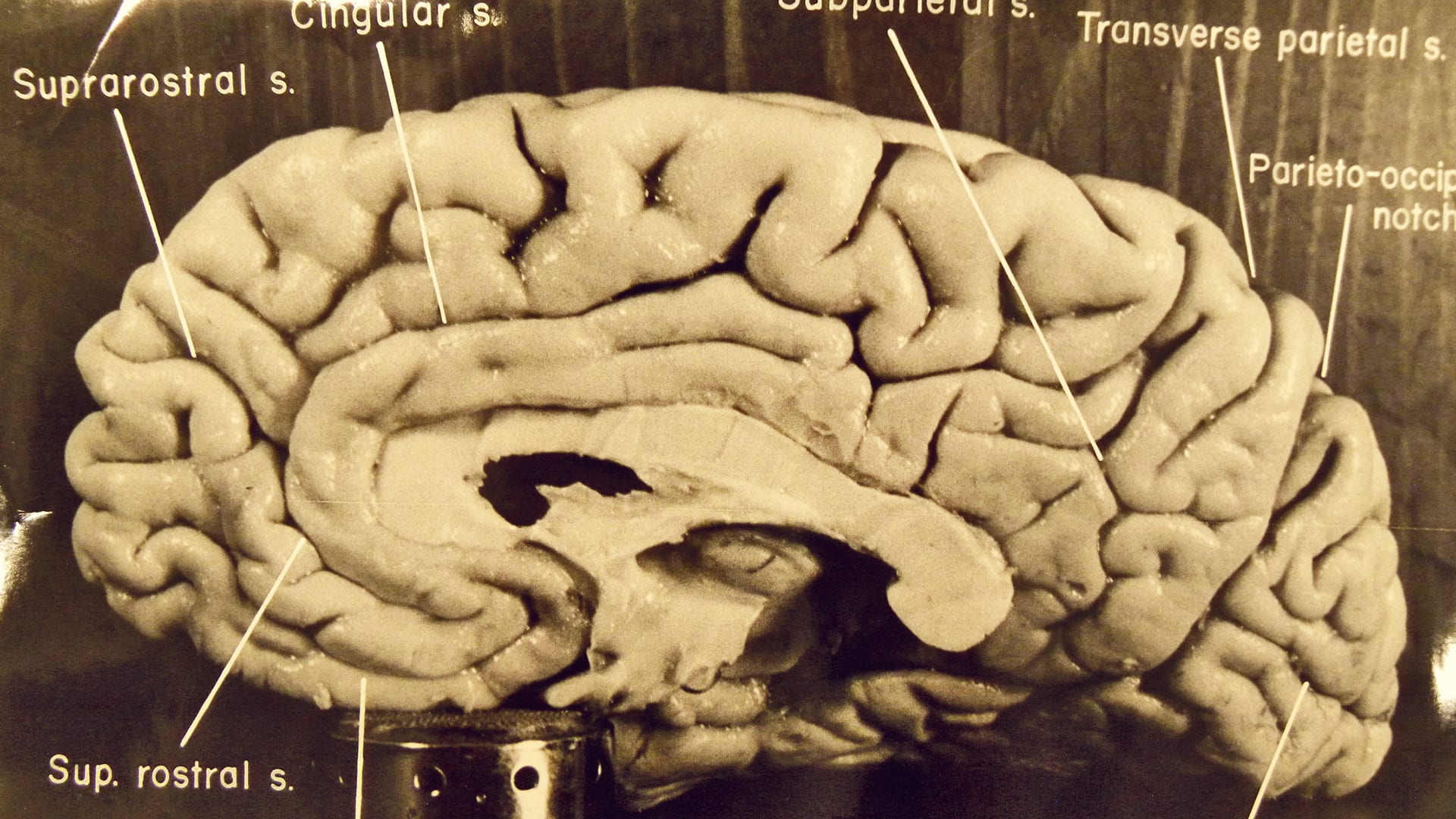 How Einstein's Brain Was Probably Different Than Yours, And Why He Was ...