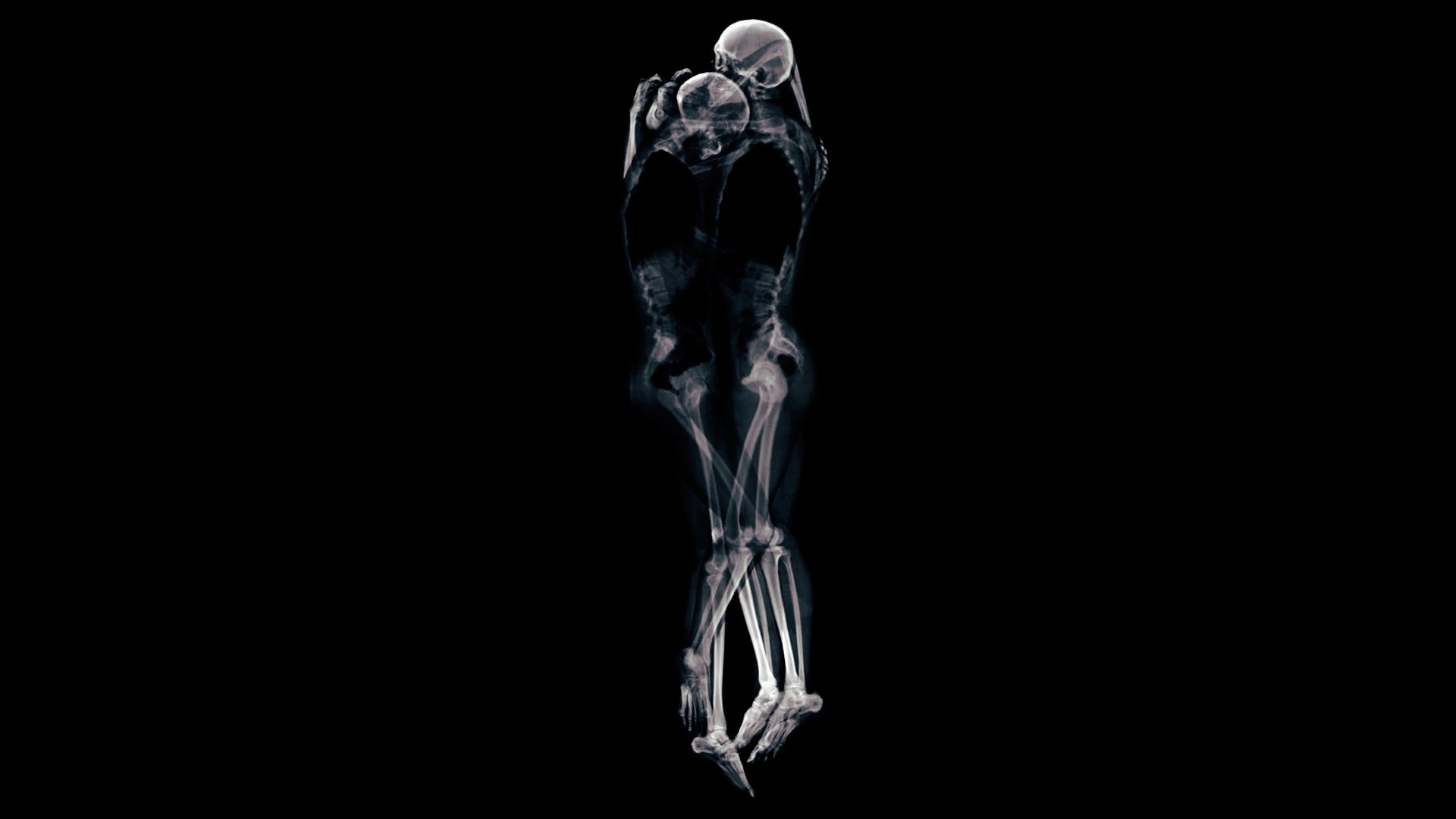 X-Ray Photos Show What Love Looks Like Beneath the Skin - Fast Company