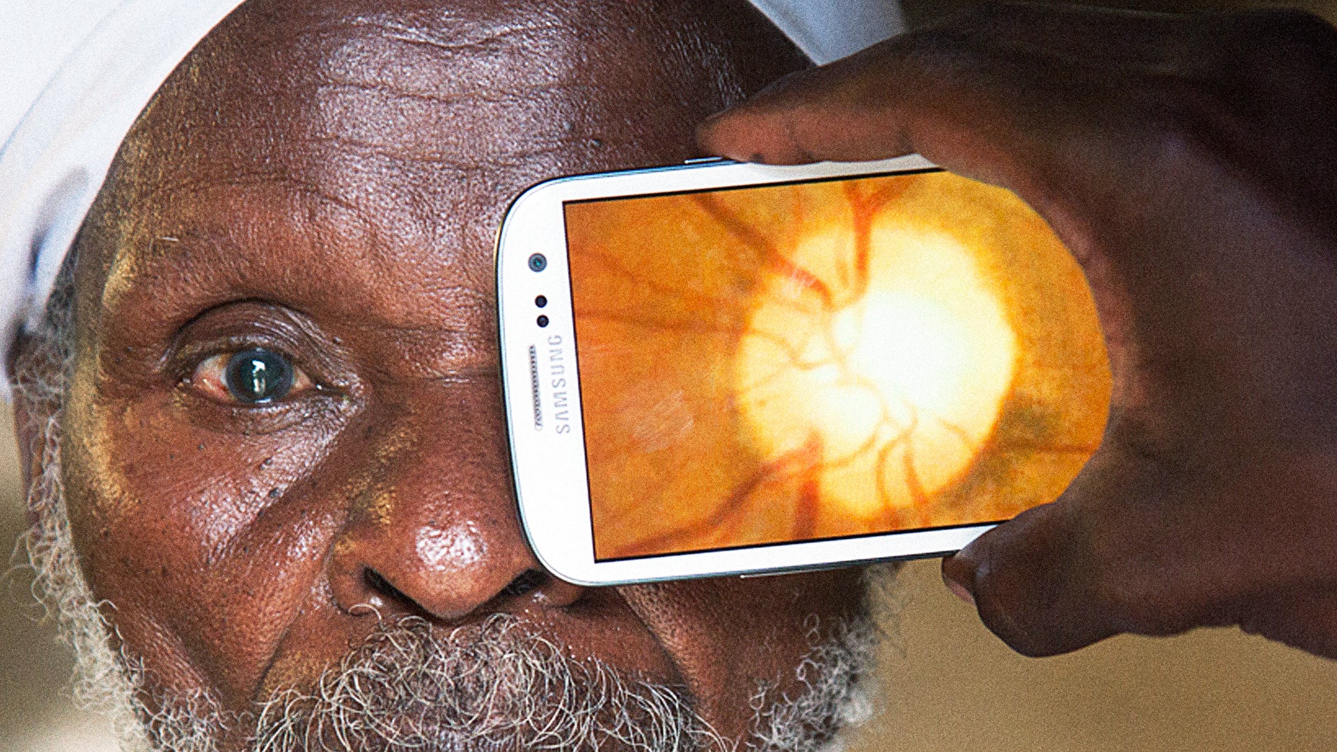 This Clever Device Turns Phones Into Sophisticated Eye Exam Machines ...