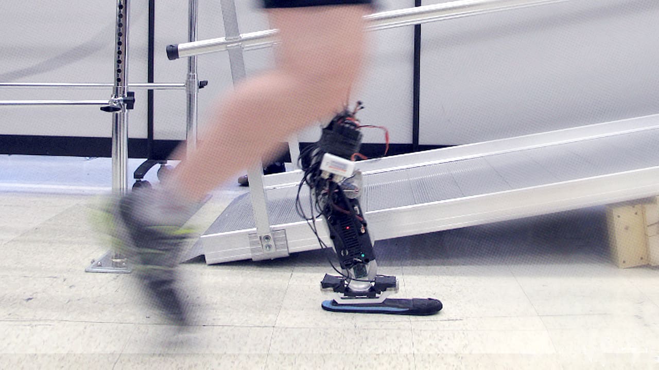 This Astonishing Robot-Inspired Prosthetic Promises Amputees An Easier ...