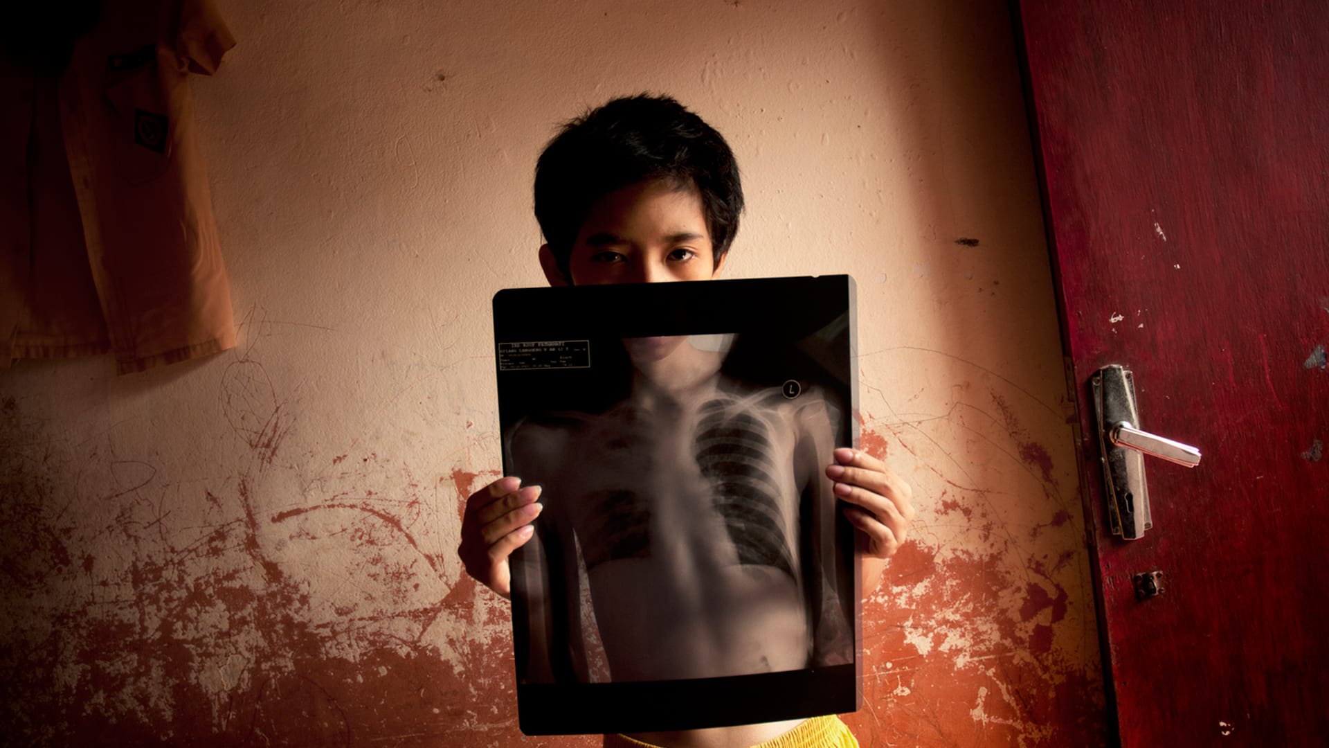 These Devastating Images Show The Global Struggle For Health Care That ...