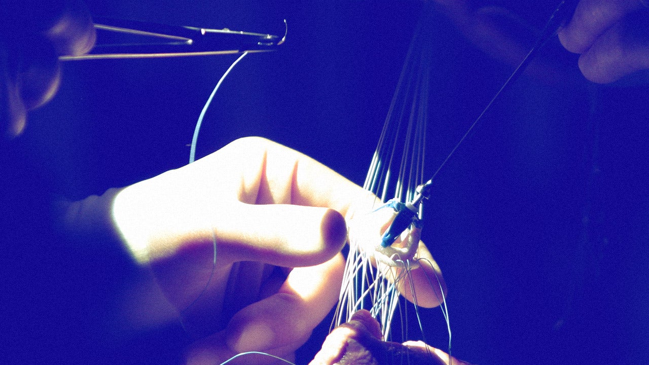 Researchers Create "Cyborg Heart Patch” - Fast Company