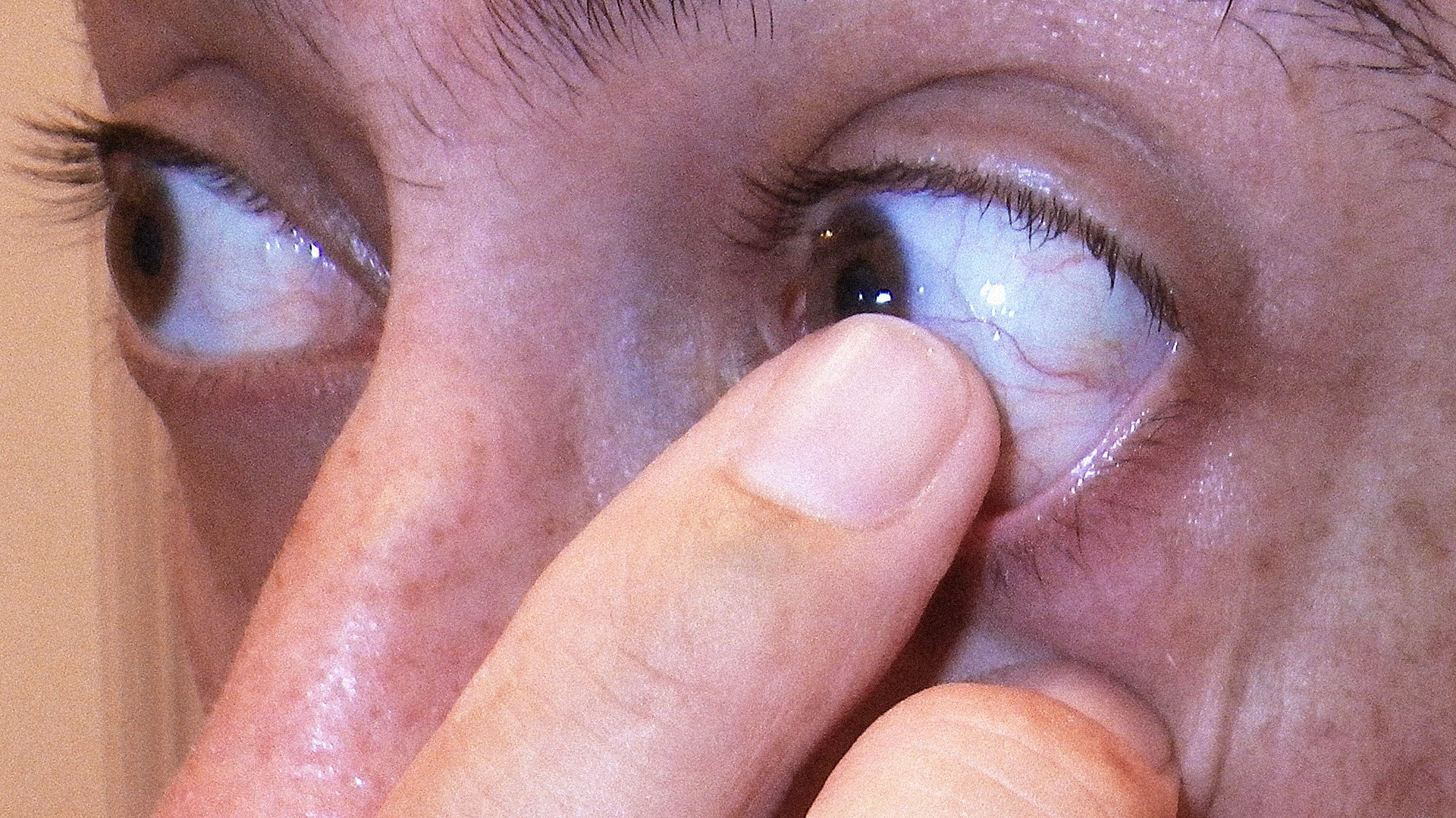 How Contact Lenses Lead To Dry Eyes-And How We Could Fix It - Fast Company