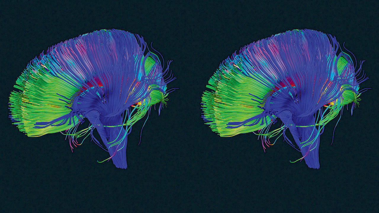 Your Brain Has A "Delete" Button-Here's How To Use It - Fast Company