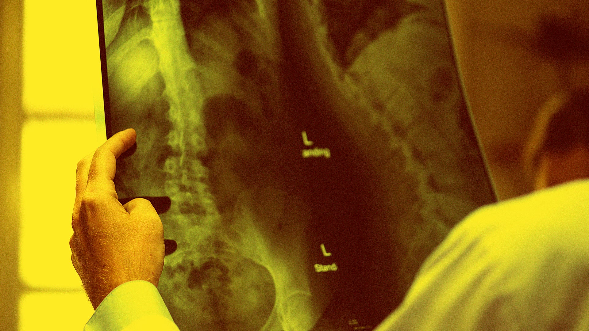 Hiding my chronic illness from my coworkers almost killed me - Fast Company
