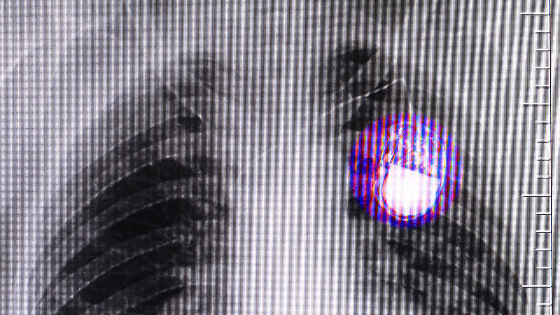 Apple's wireless charging tech may interfere with pacemakers - Fast Company