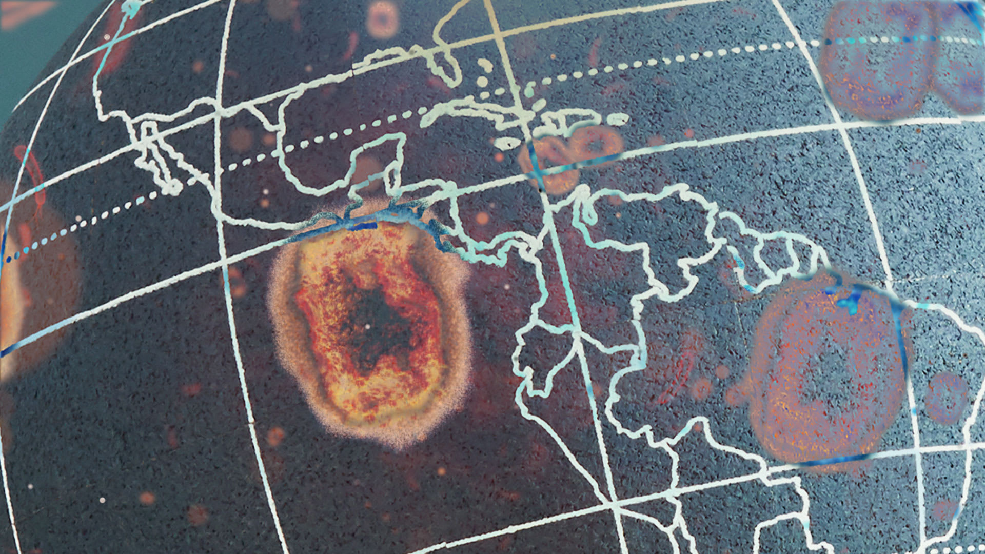 Monkeypox in the US: This map shows states where it's spreading as WHO ...