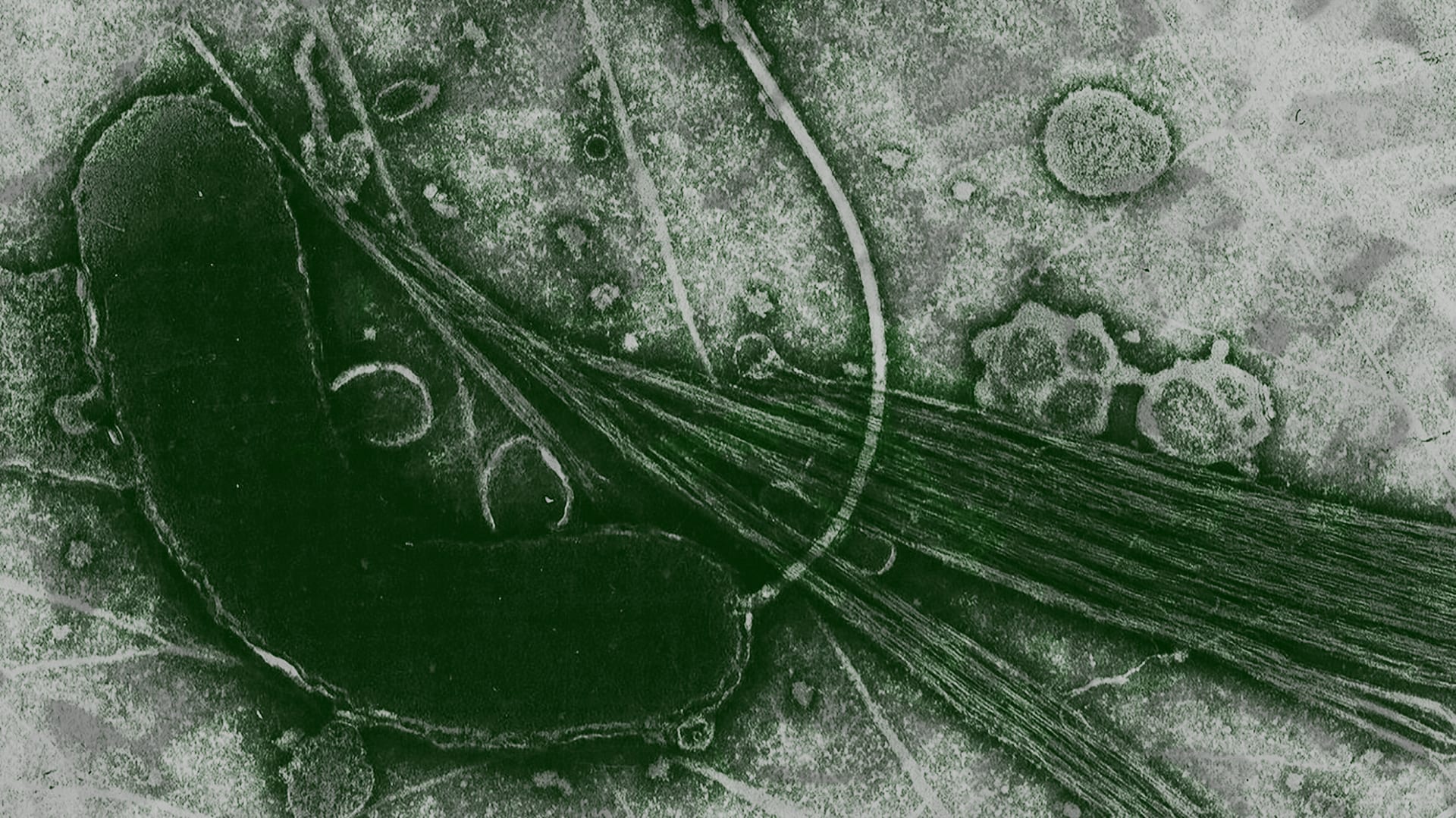 Cholera outbreaks are surging—and climate change is making them far worse