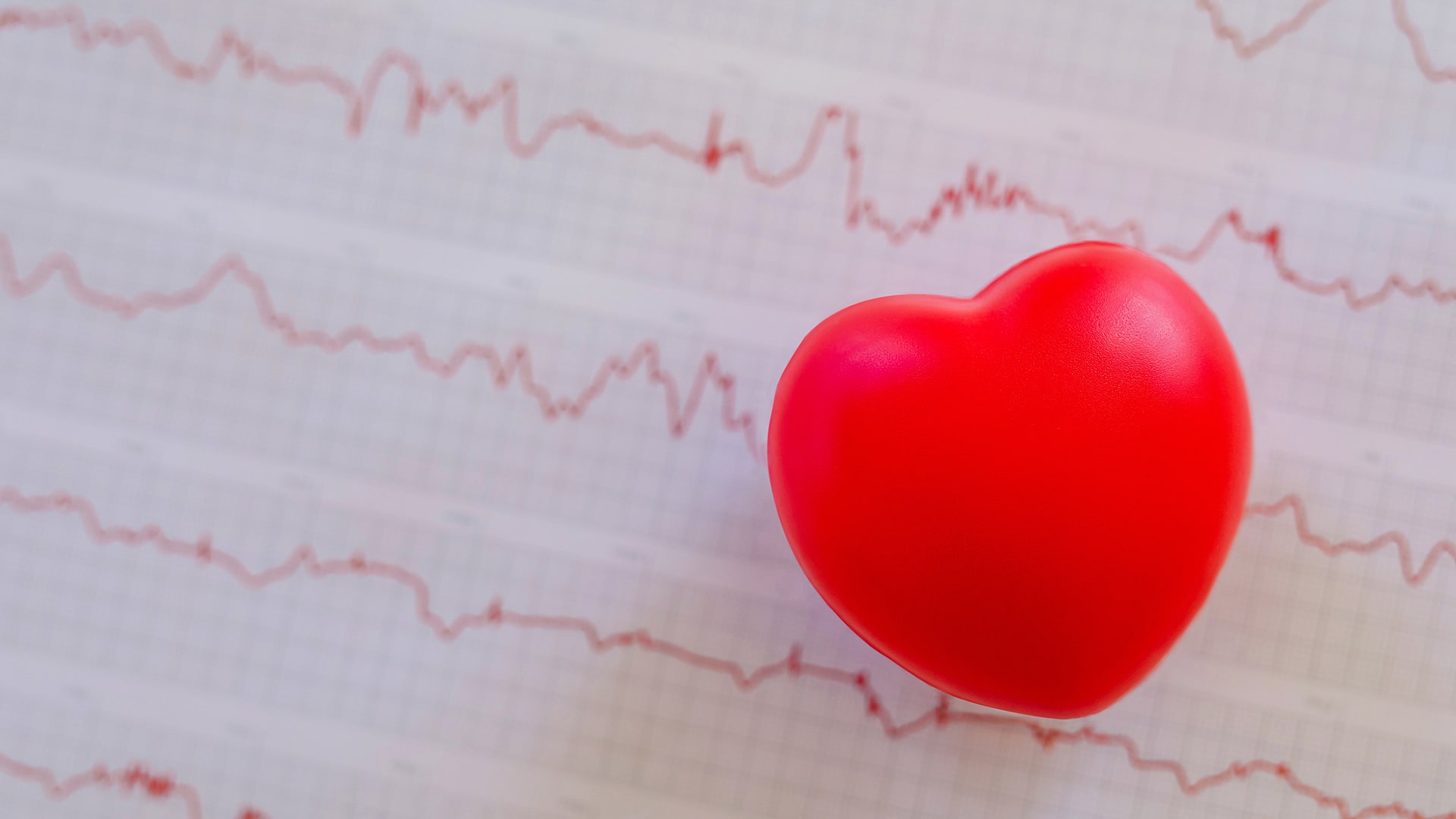A new approach to AFib