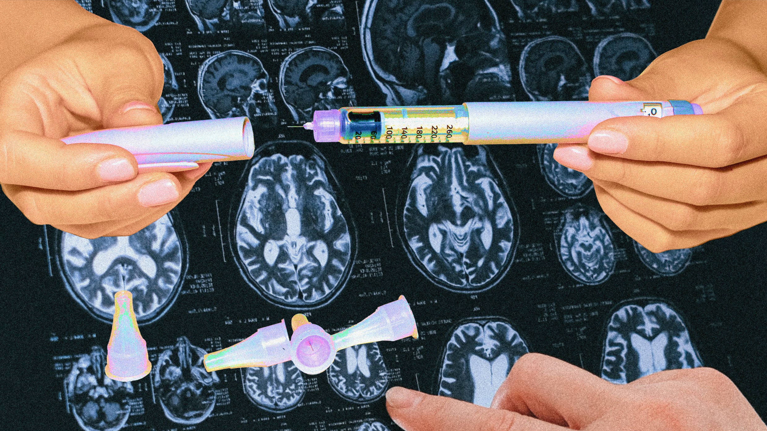 Do weight loss drugs like Ozempic cause depression—or help treat it?