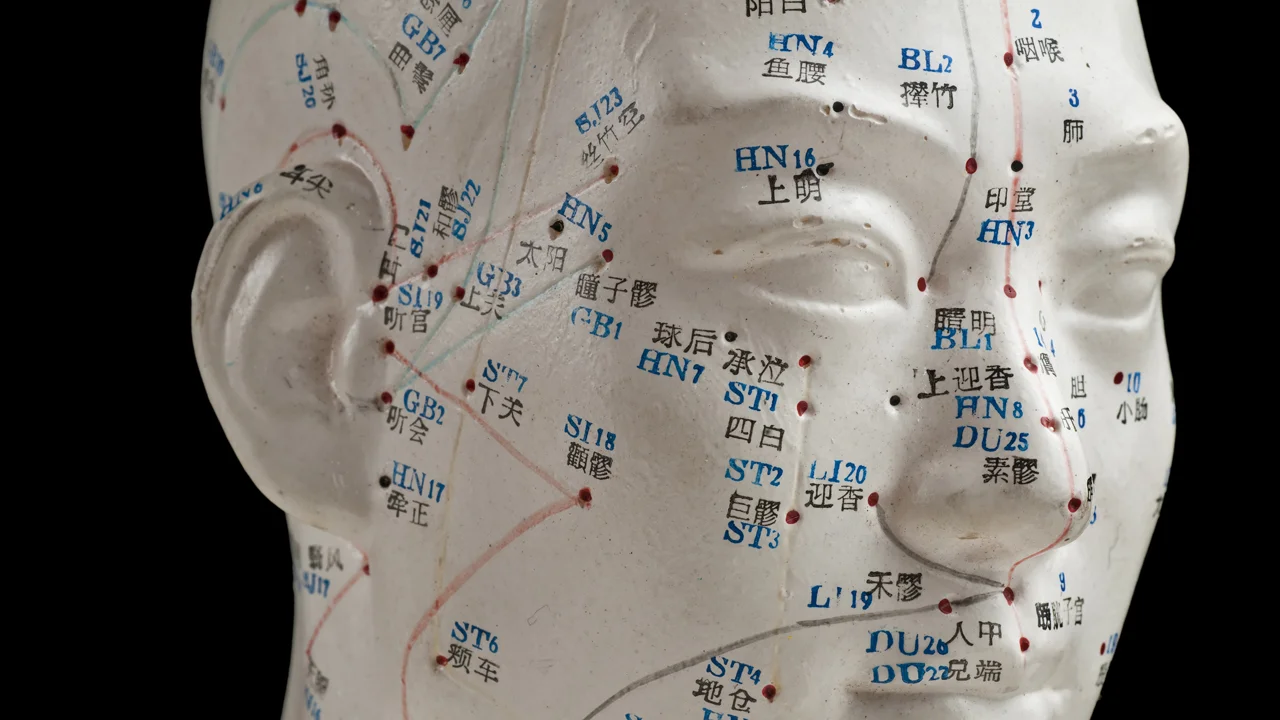 A New High-Tech Upgrade To Acupuncture Lets You See It's Working In ...