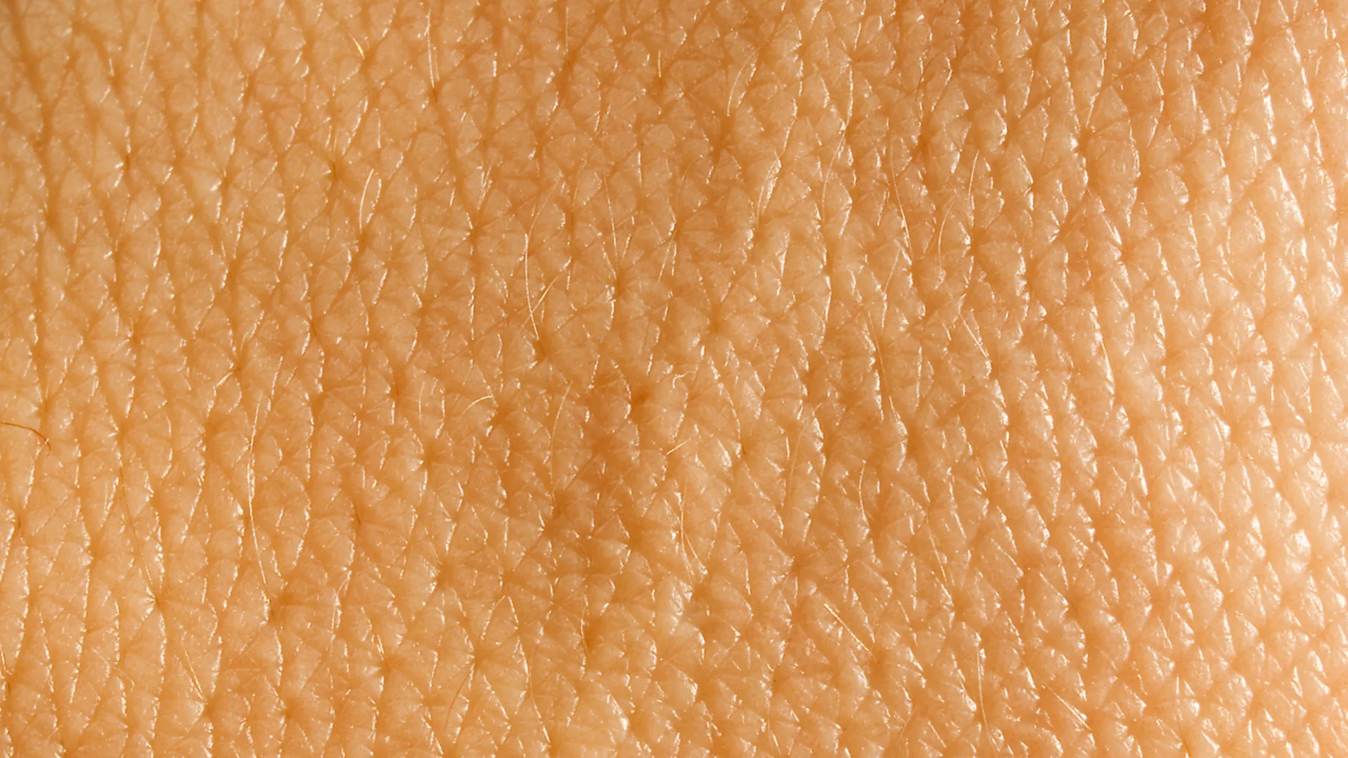 How MelaFind Uses Military Tech To Find Cancer - Fast Company