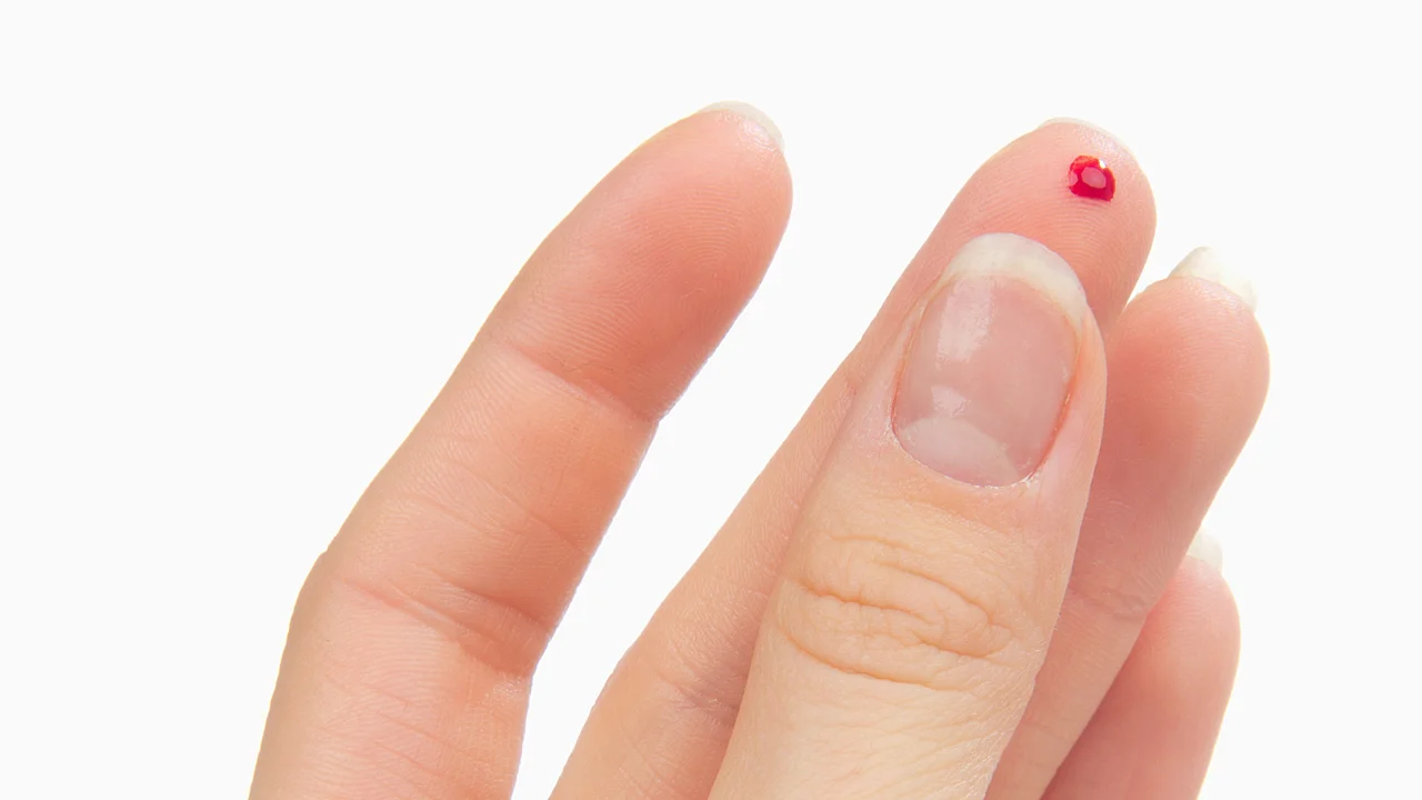A Mobile Device That Diagnoses STDs On The Spot With A Simple Finger ...
