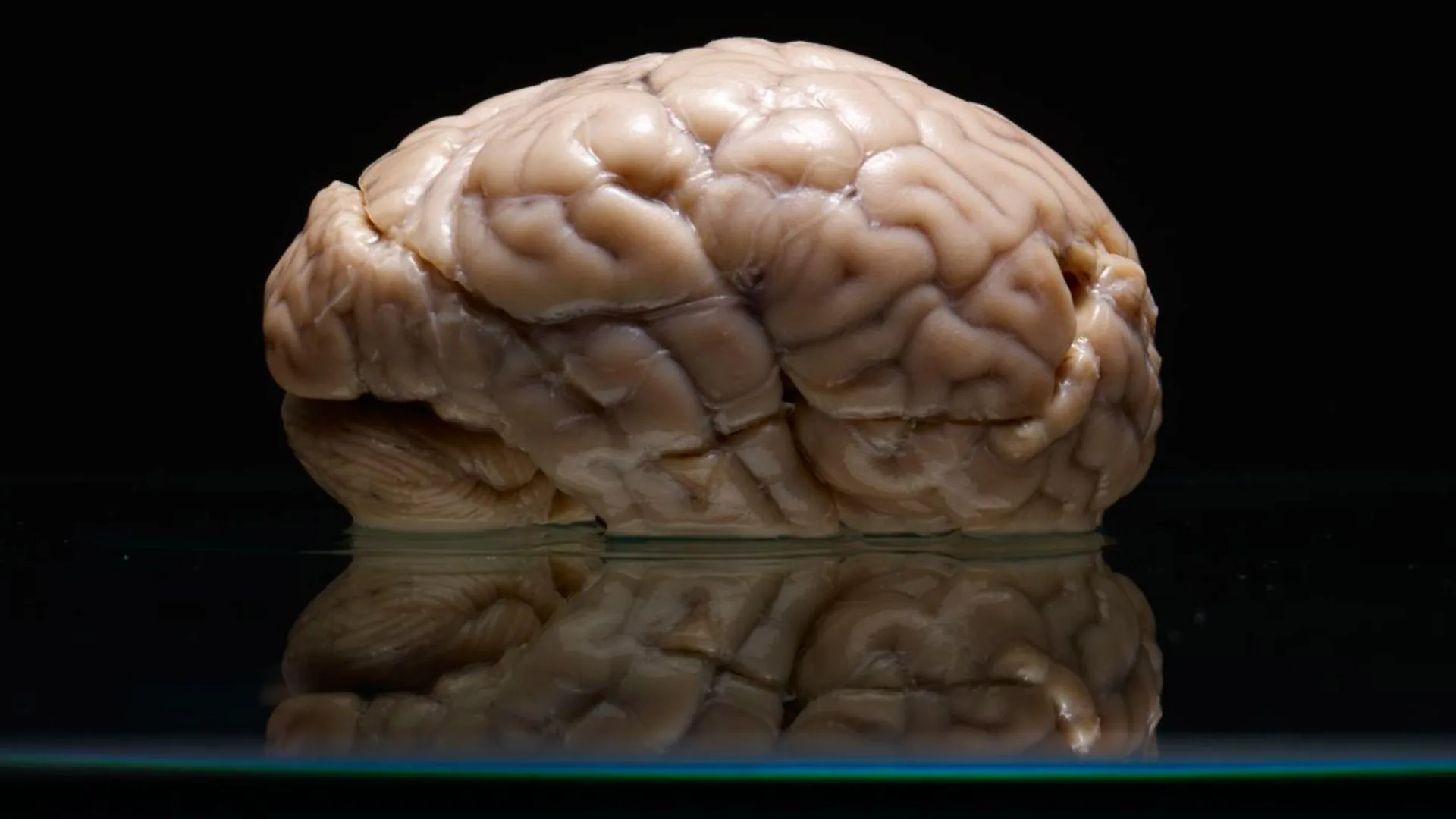 Amazing Photographs Of A Giant, Forgotten Collection Of Human Brains ...
