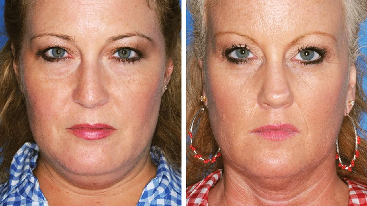 See How Smoking Will Ruin Your Face, With These Side-By-Side Images Of ...