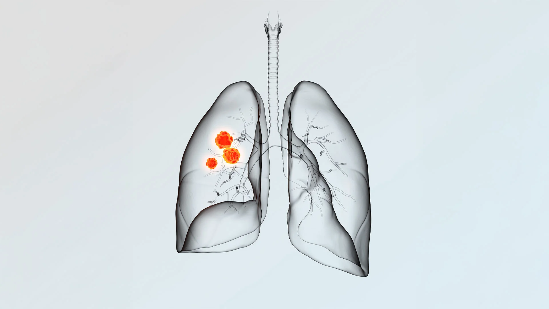 New AI maps tumors in 3D as patients breathe - Fast Company
