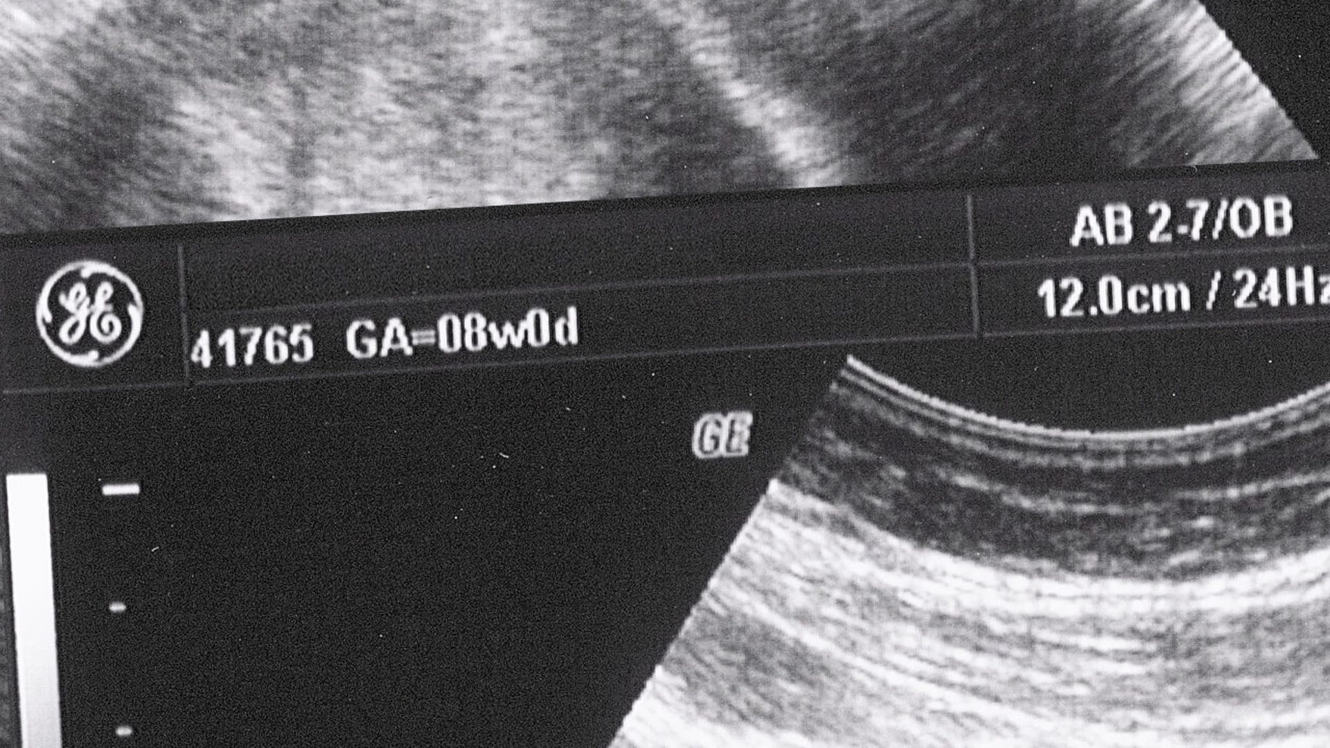 How GE Branded My Unborn Baby - Fast Company