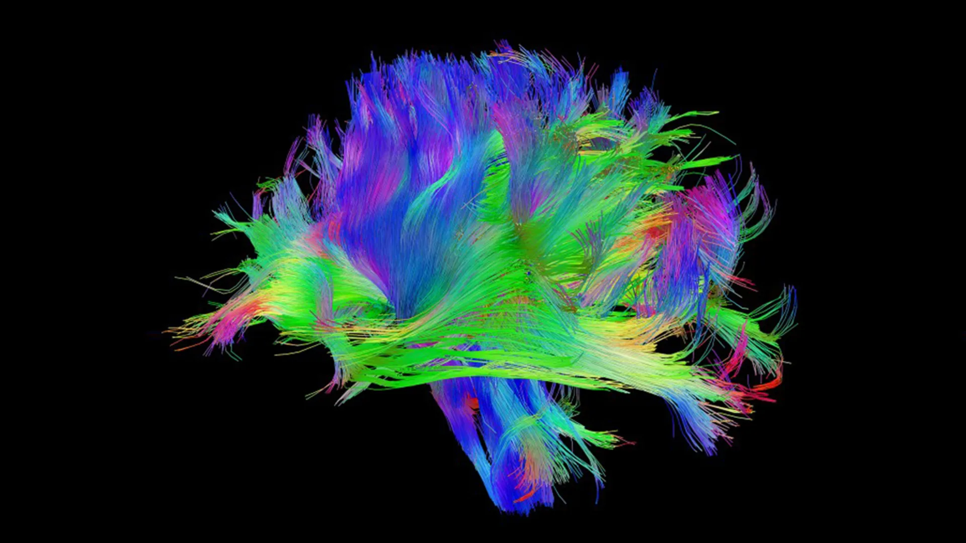 8 Mind-Blowing Images Of The Brain At Work - Fast Company