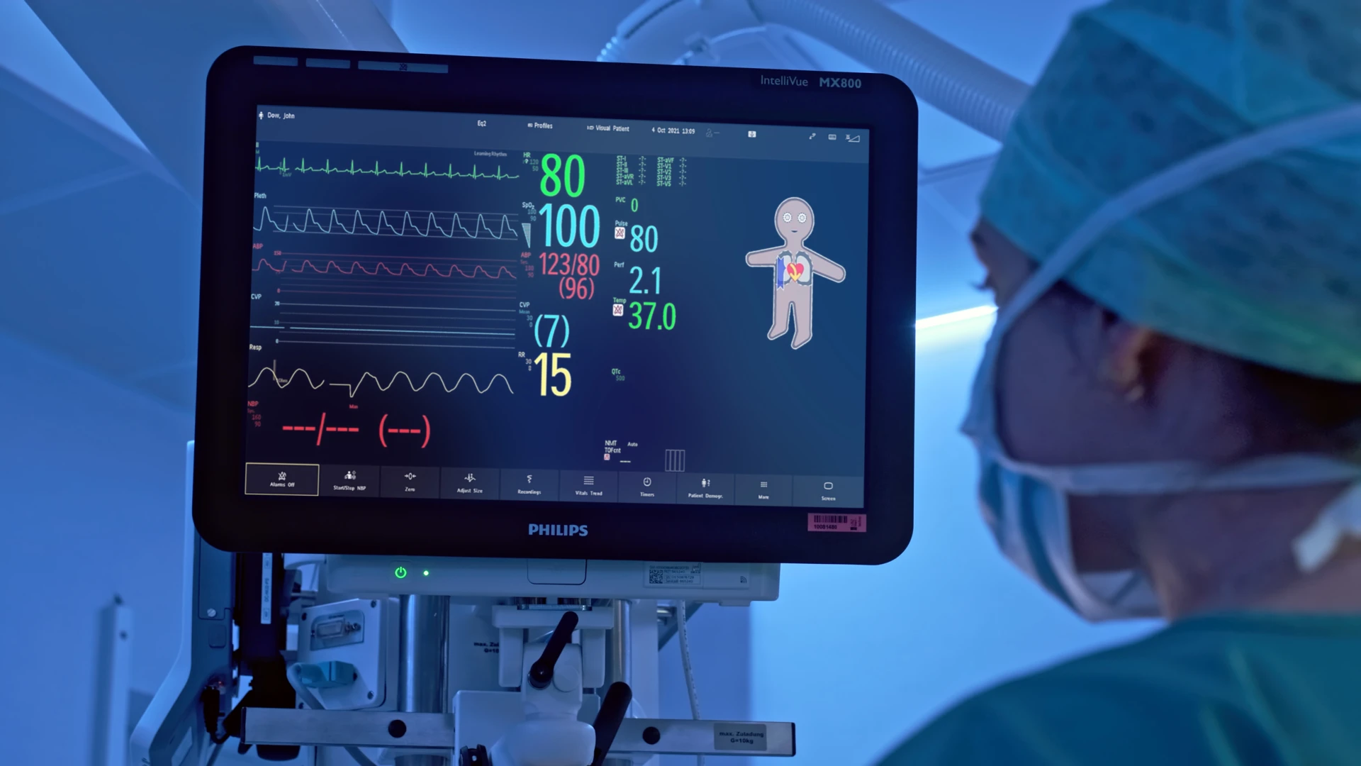 Philips partnered with anesthesiologists to redesign the patient monitor