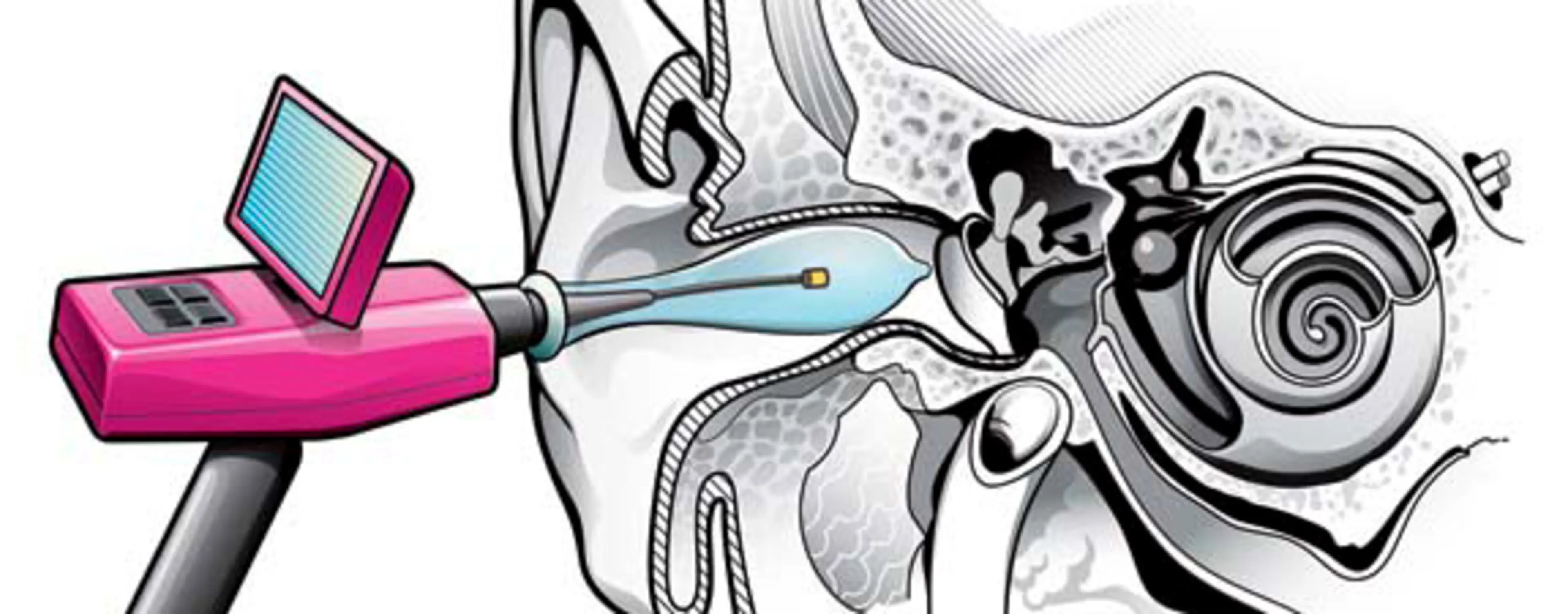 MIT's 3-D Digital Scanner Dives Deep Into the Ear - Fast Company