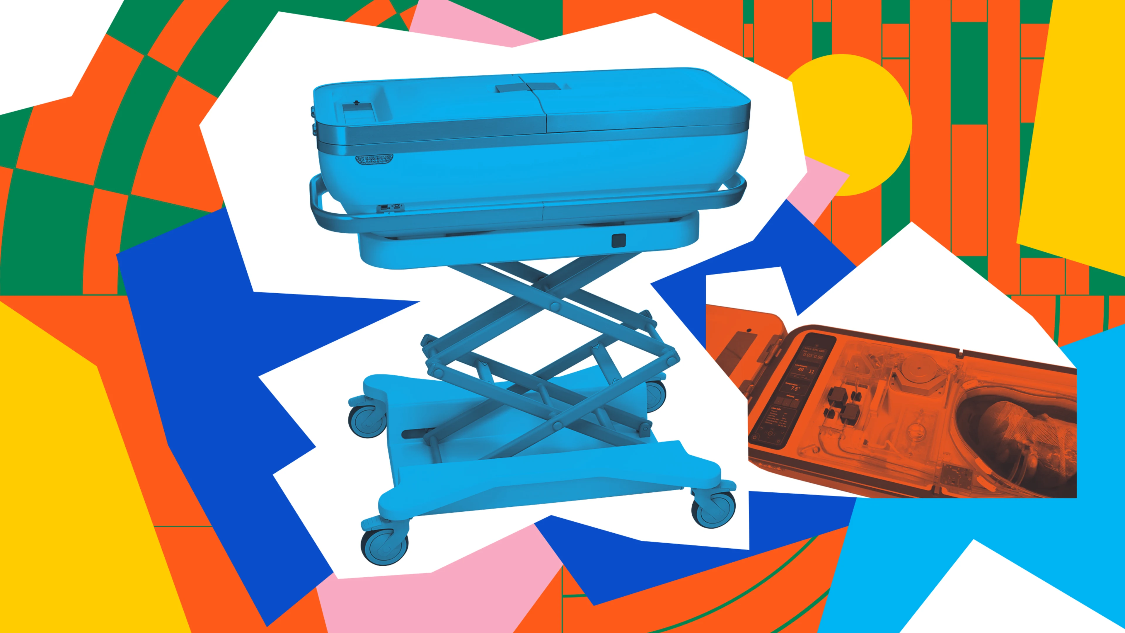 The LifePort Liver Transporter treats the donor organ like a patient