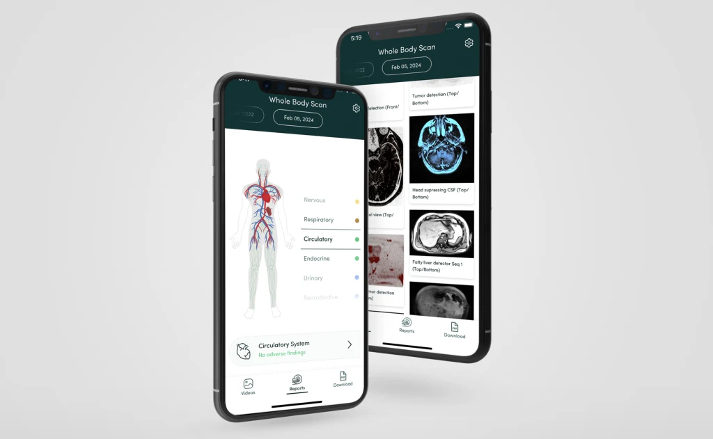 Prenuvo wants its full-body scans to redesign healthcare - Fast Company