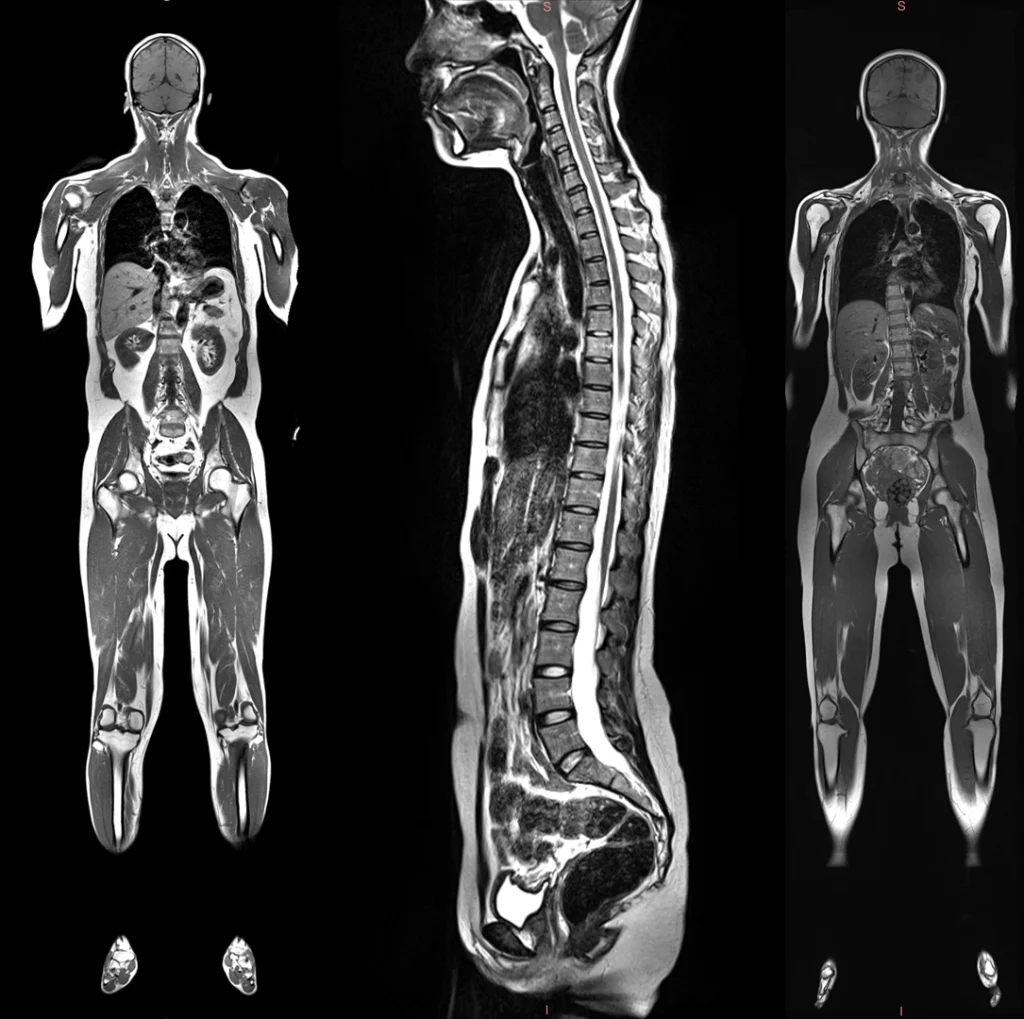 Prenuvo wants its full-body scans to redesign healthcare - Fast Company