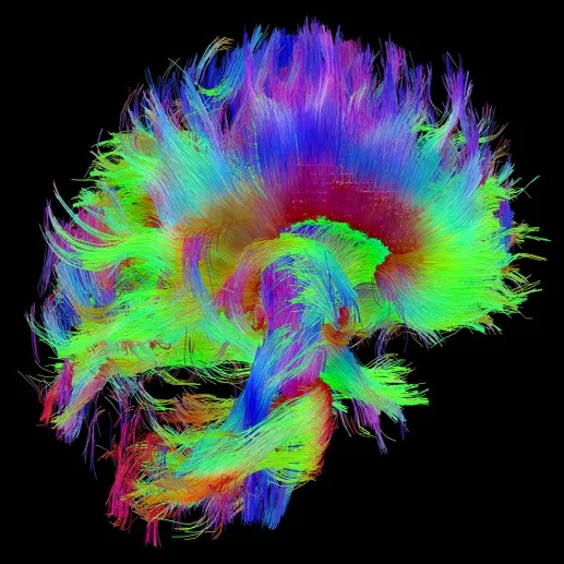 8 Mind-Blowing Images Of The Brain At Work - Fast Company