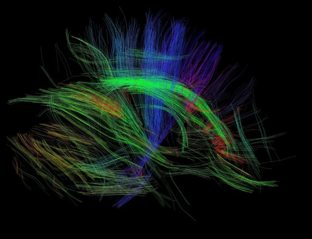 8 Mind-Blowing Images Of The Brain At Work - Fast Company