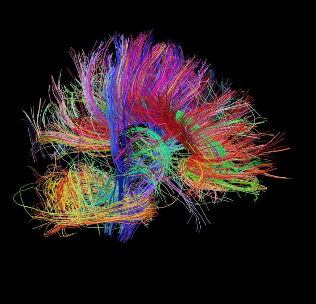 8 Mind-Blowing Images Of The Brain At Work - Fast Company