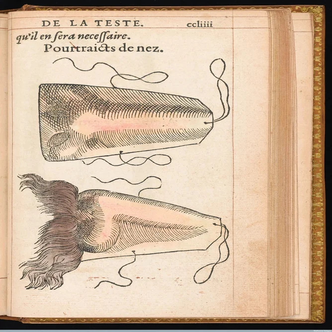 The Morbid History Of Victorian Surgery, Beautifully Illustrated - Fast ...