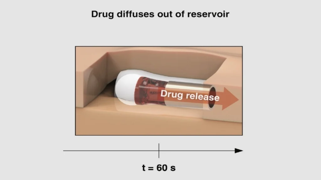 This revolutionary device would automatically reverse opioid overdoses ...