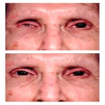These Artificial Eyes Are Hauntingly Beautiful-And Made By A 3-D ...