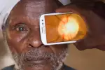 This Clever Device Turns Phones Into Sophisticated Eye Exam Machines ...