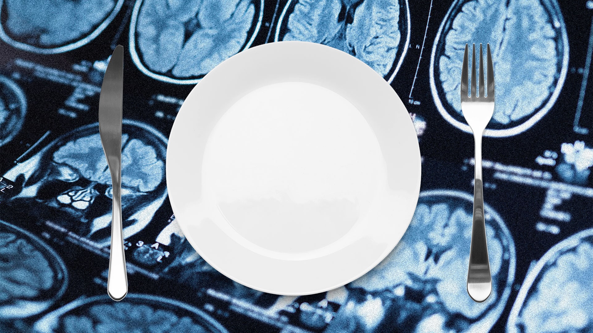 Eating disorders may hurt brain development, MRI scans reveal - Fast ...