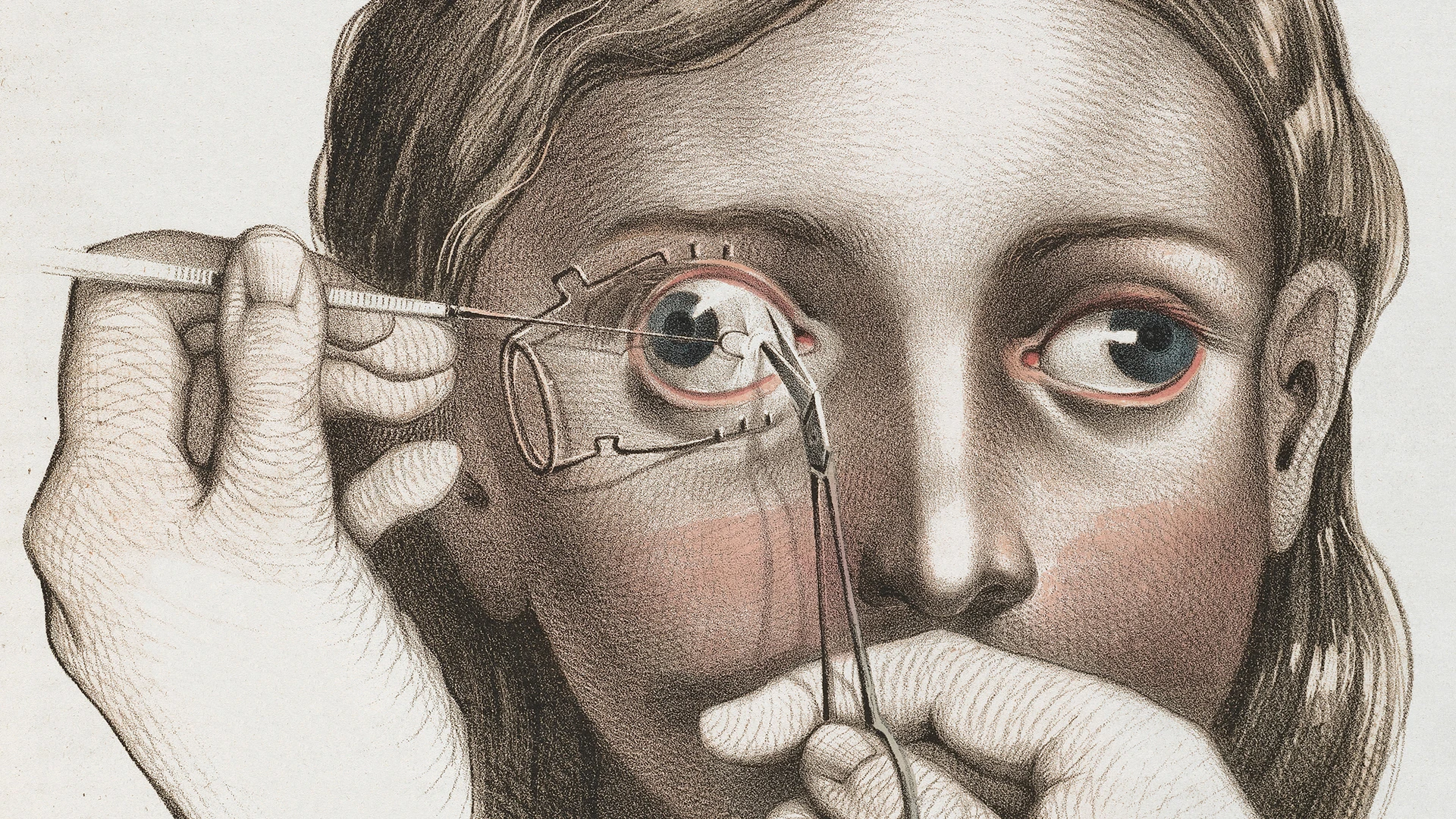 victorian day procedure