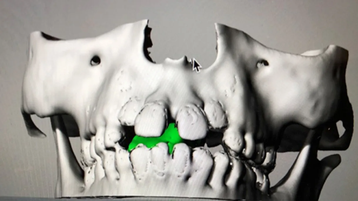 These 3D-printed body parts let surgeons practice on a model before ...