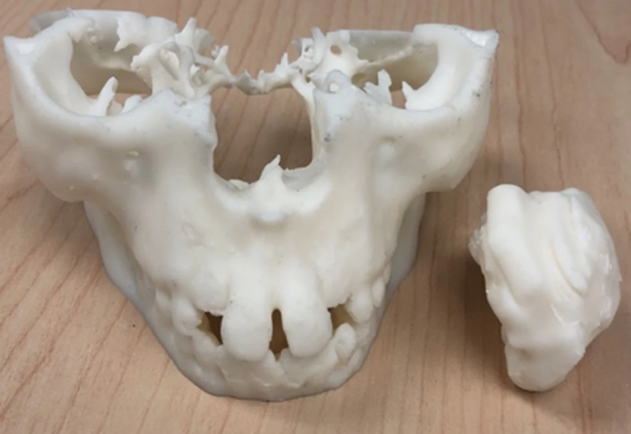 These 3D-printed body parts let surgeons practice on a model before ...