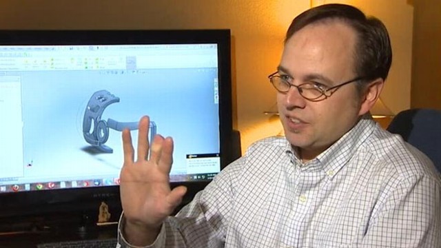 How An Amputee Built The World's First Functional Prosthetic Finger ...